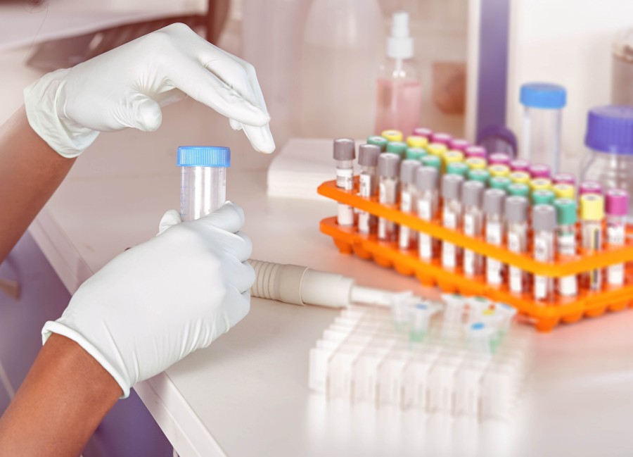 Lipid-RNA Conjugation Services - BOC Sciences